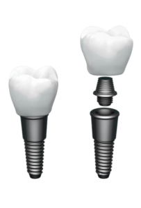 In-Network Dentists for Sleep Apnea, TMJ, and Dental Implants ...