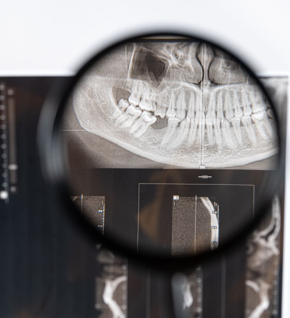 Temporomandibular Joint Disorder (TMJ) Treatment | Dedicated Sleep (888 ...